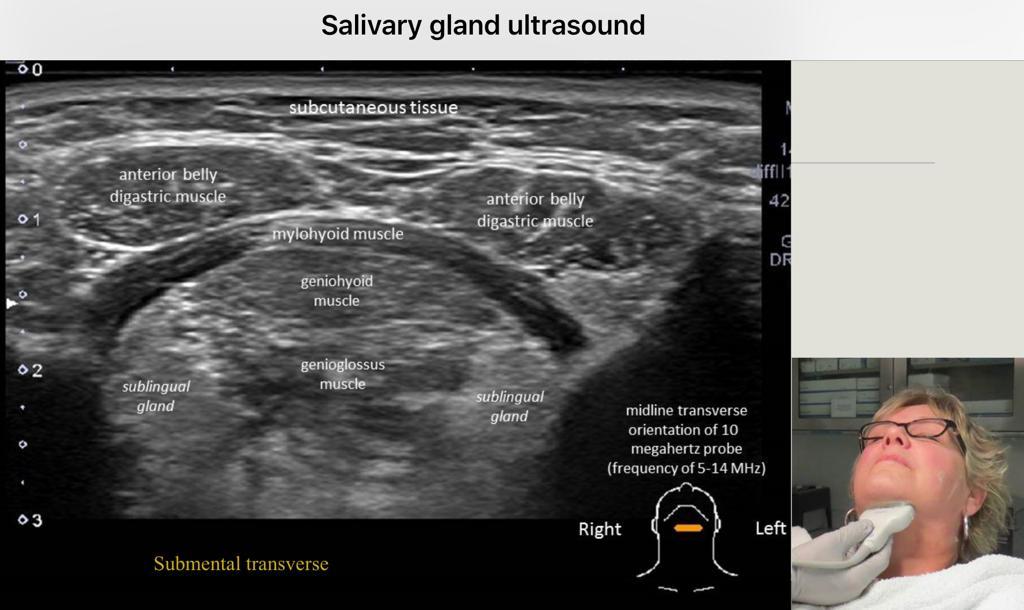 Soft tissue ultrasound - Specialized Radiology Services of Dr. Yaser ...