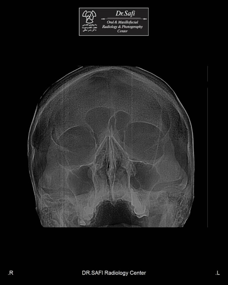 Waters Radiography - Specialized radiology services of Dr. Yaser Safi ...